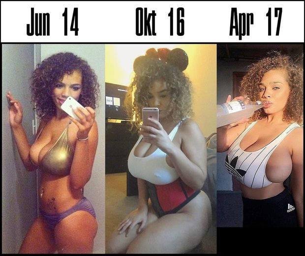 Breast Growth Drgray