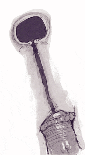 X Ray S
