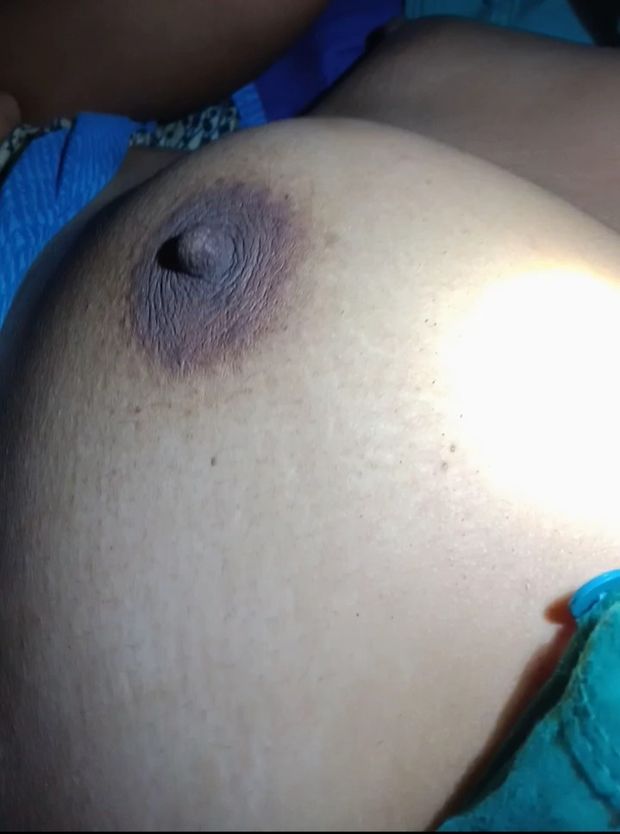 Big Boob Press Nipples Biaray